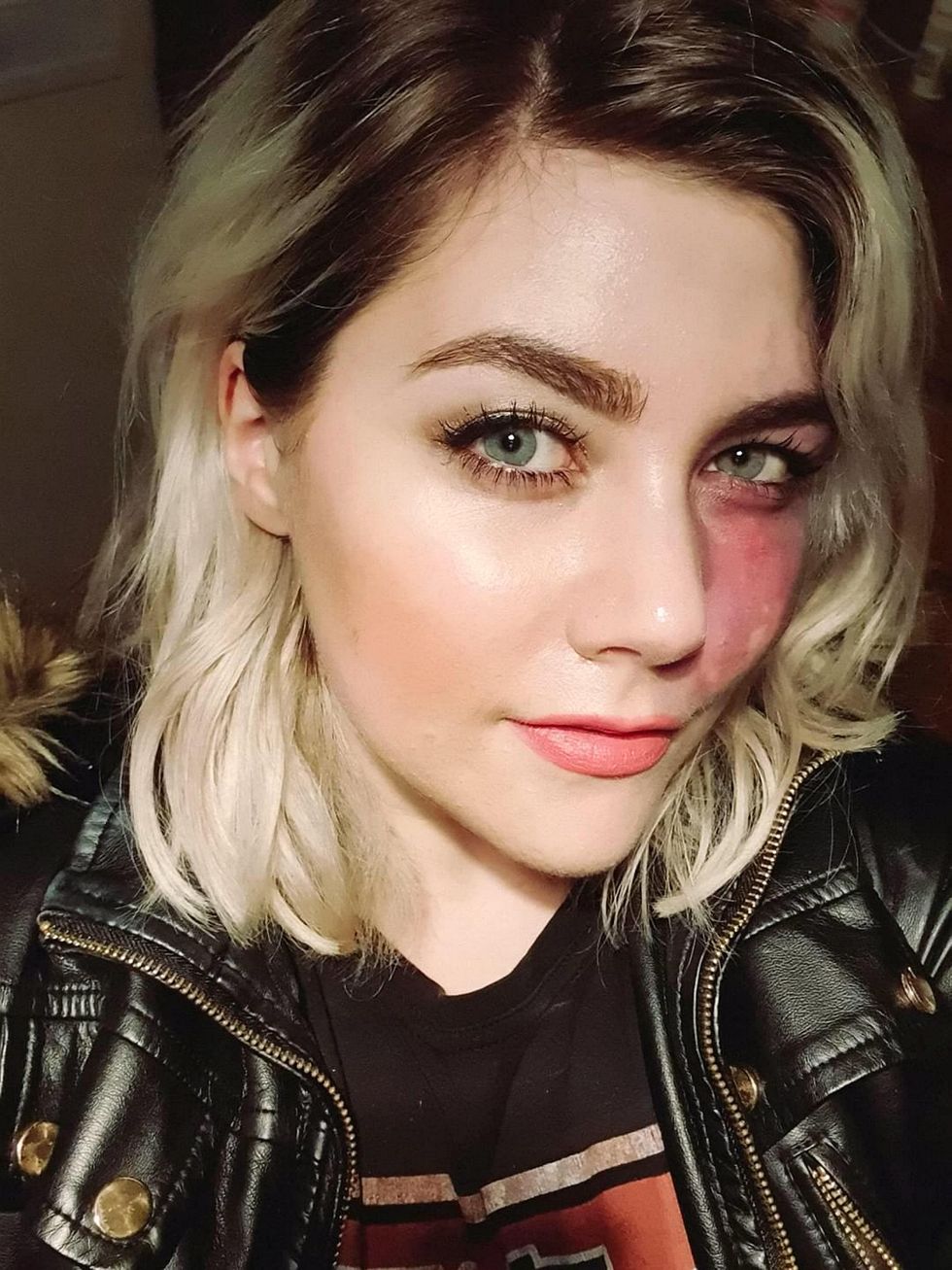 Woman inundated with emails from men after her birthmark photo went ...