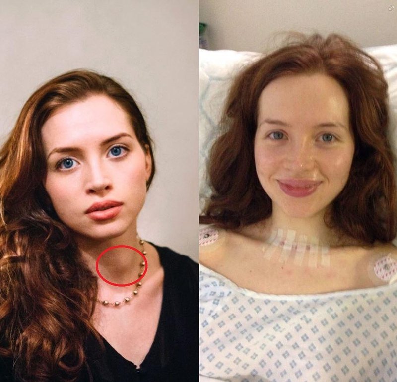 Celebrities Hypothyroidism 60 Photos - Moonagedaydream.film