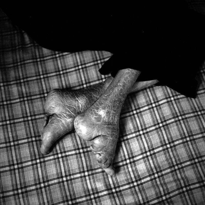 Modern Foot Binding Try This: 5 Reasons Why Your Shoes Might Be